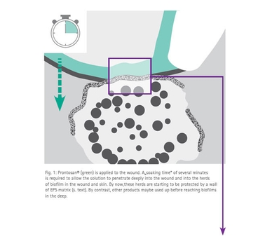 Biofilm Based Wound Care | B. Braun Australia - B. Braun