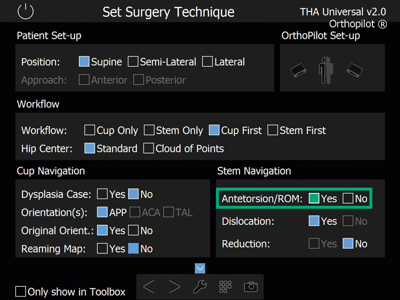 THA Pro navigation software hip arthroplasty - B. Braun