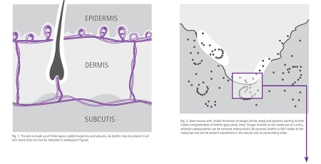 Biofilm Based Wound Care | B. Braun Australia - B. Braun