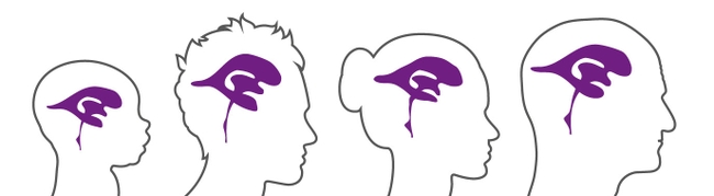 Why does it need better solutions for the treatment of hydrocephalus ...