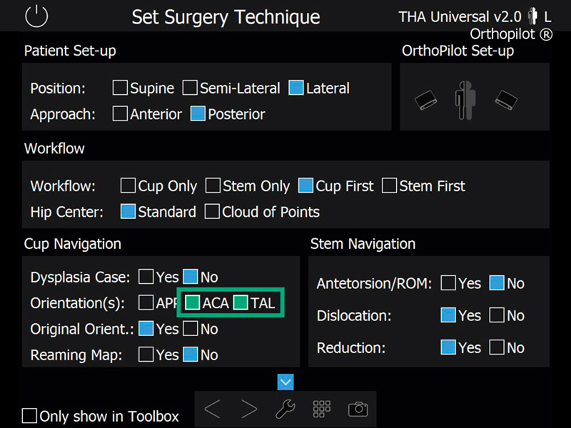 THA ACA navigation software hip arthroplasty| B. Braun Australia - B. Braun