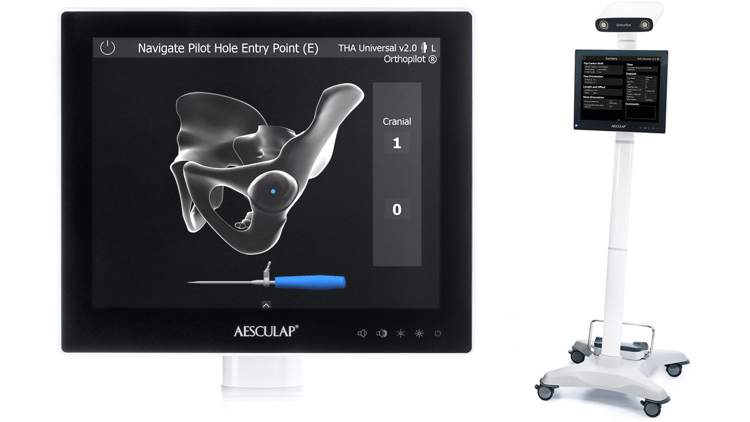 THA Dysplasia navigation software hip arthroplasty | B. Braun Australia ...