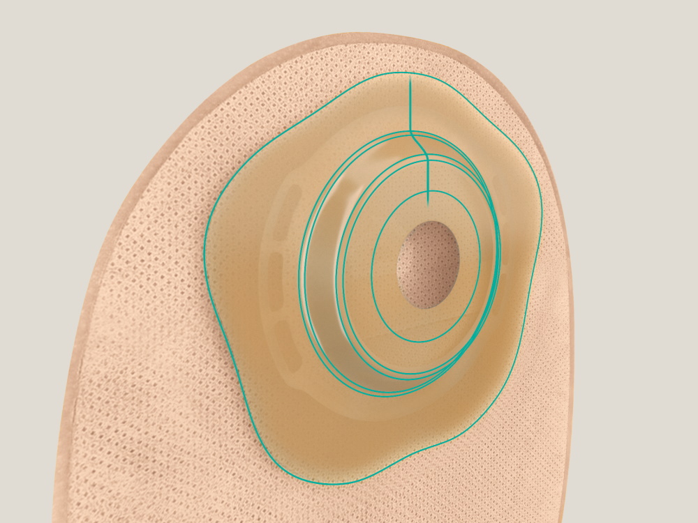 Convex Stoma Bags Against Stoma Leakages | B. Braun Australia - B. Braun