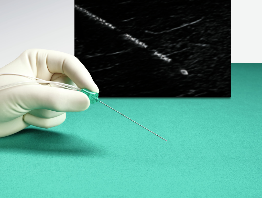 New digital microscope technology for neurosurgery - B. Braun